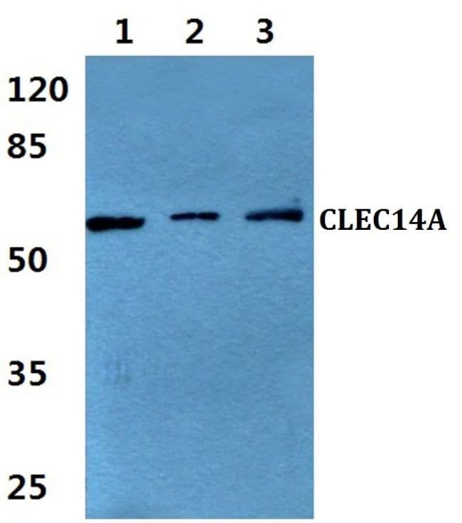 CLEC14A Polyclonal Antibody, Invitrogen 100 μL; Unconjugated:Antibodies ...