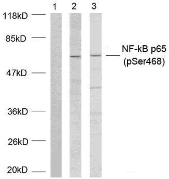 Phospho-NFkB p65 (Ser468) Rabbit anti-Human, Mouse, Rat, Polyclonal ...