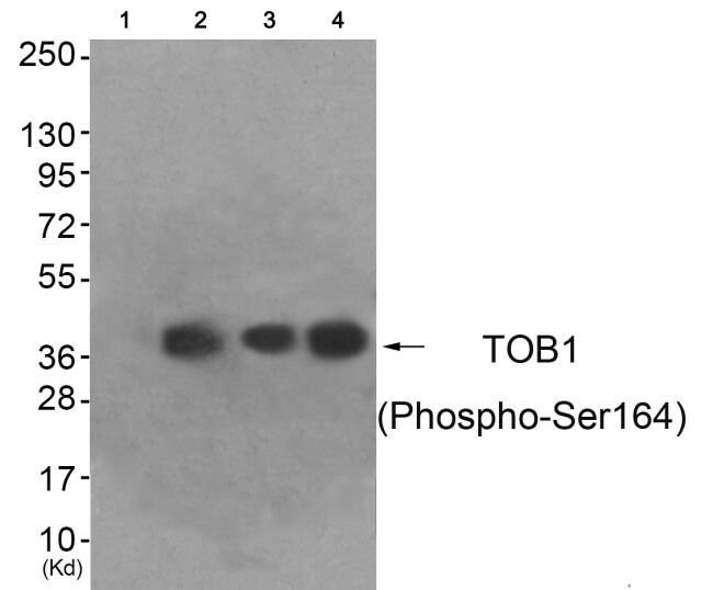 Phospho-TOB1 (Ser164) Rabbit anti-Human, Mouse, Rat, Polyclonal ...