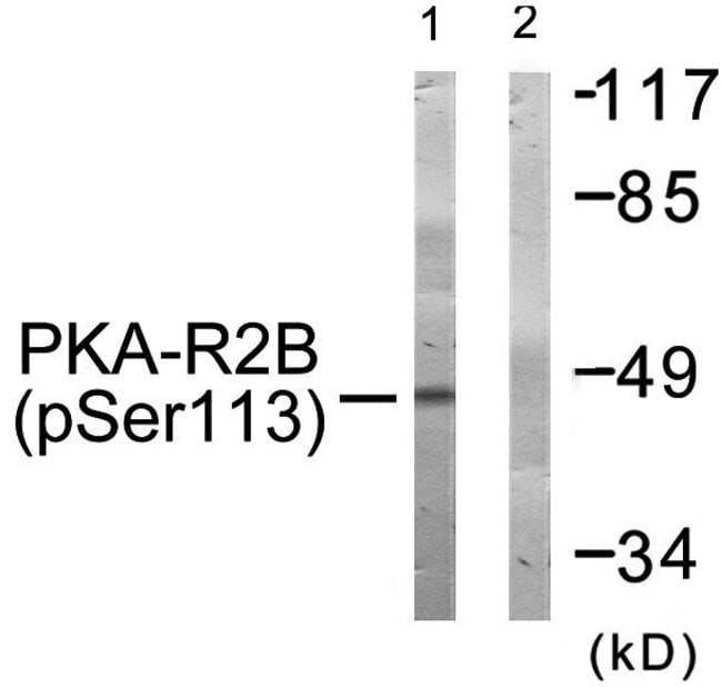 Phospho-PRKAR2B (Ser113) Rabbit anti-Human, Mouse, Non-human primate ...