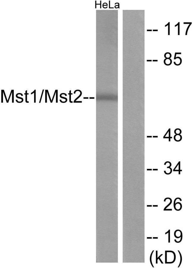 MST1/MST2 Polyclonal Antibody, Invitrogen 100 μg; Unconjugated ...