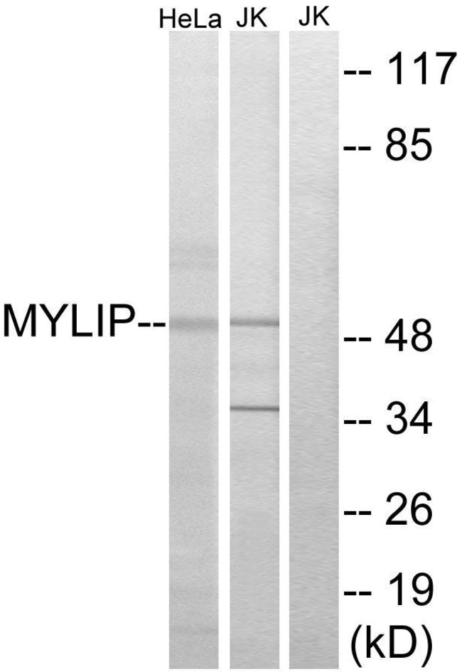 MYLIP Polyclonal Antibody, Invitrogen™ 100 μg; Unconjugated Primary ...