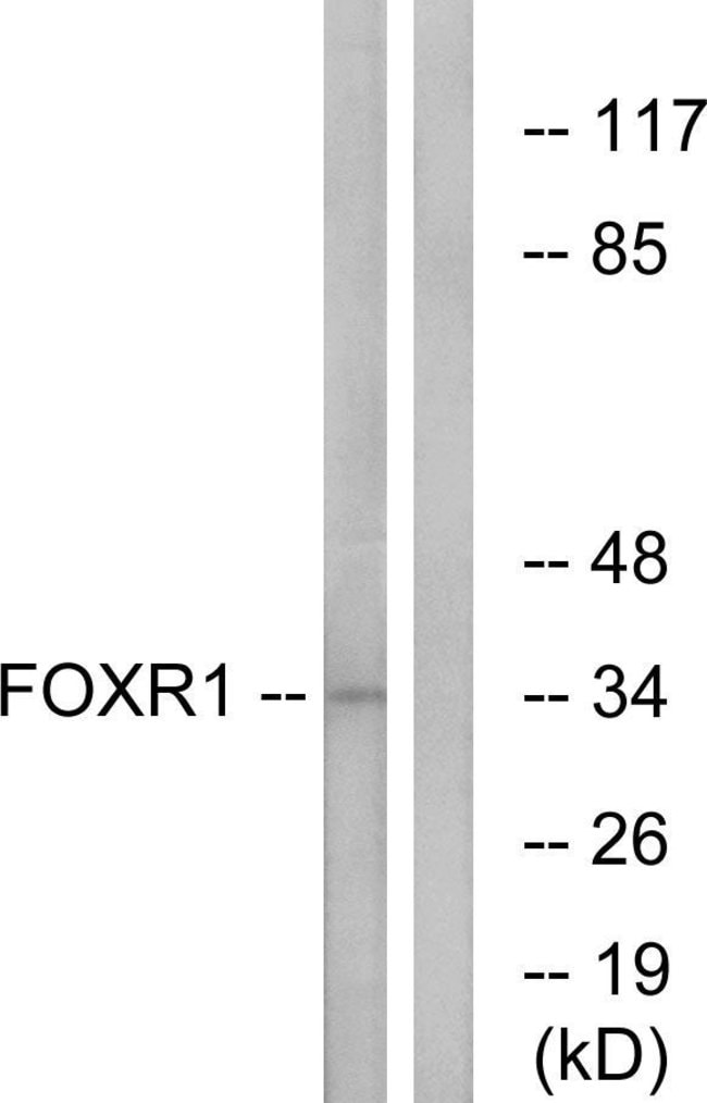 FOXR1 Polyclonal Antibody, Invitrogen 100 μg | Buy Online | Invitrogen ...