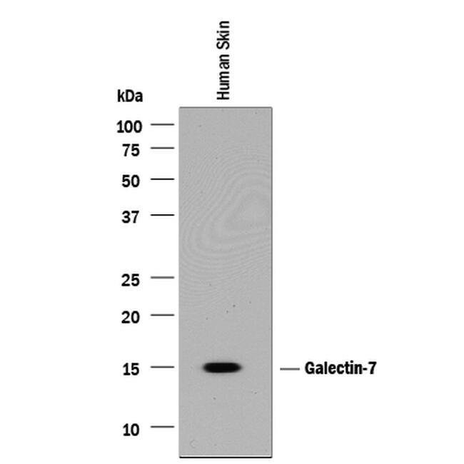 Galectin 7 Polyclonal Antibody, Invitrogen 100 μg; Unconjugated ...
