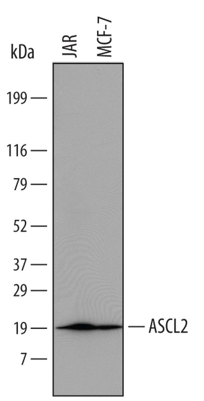 ASCL2 Sheep anti-Human, Polyclonal, Invitrogen™ 100 μg; Unconjugated ...