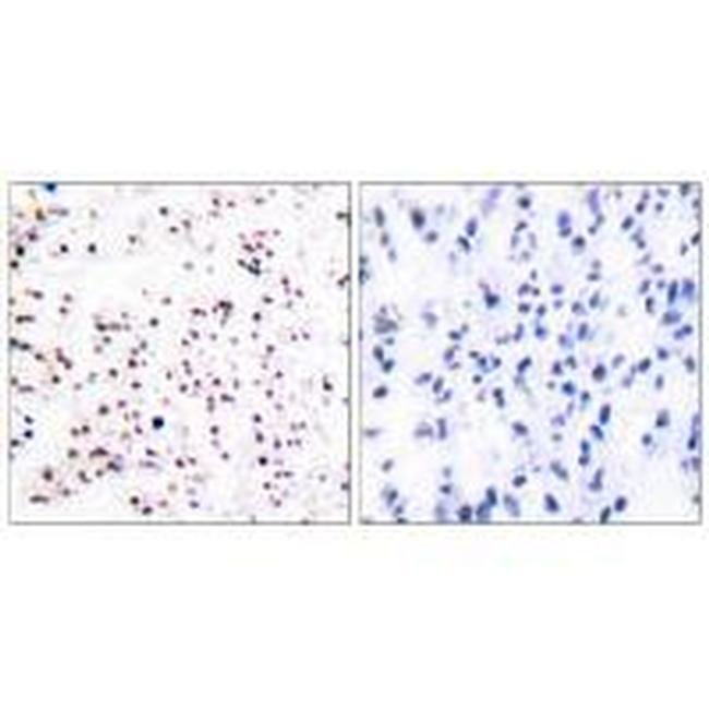 MCM5 Polyclonal Antibody, Invitrogen™ 100 μL; Unconjugated MCM5 ...