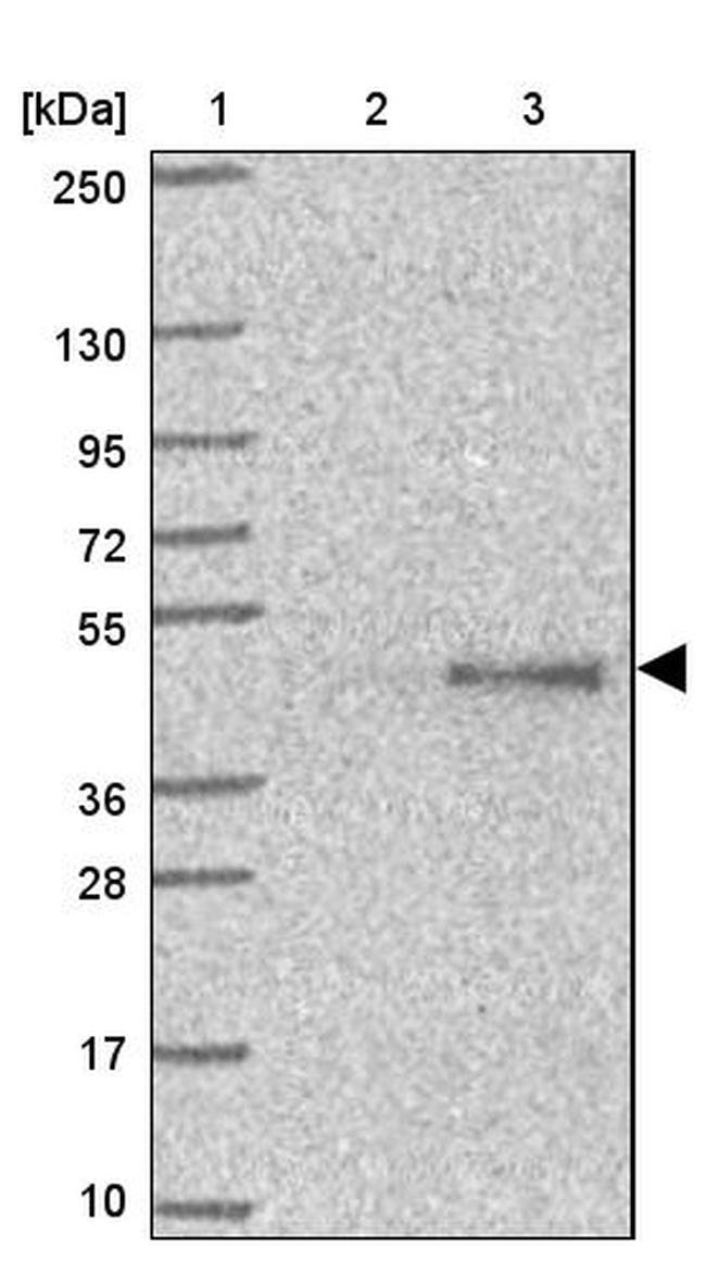 SAV1 Polyclonal Antibody, Invitrogen 100 μL; Unconjugated:Antibodies ...