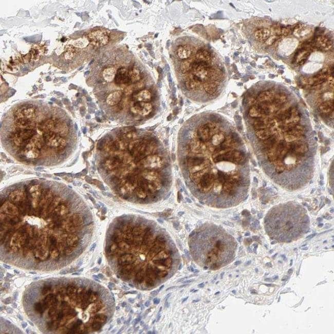 AP1G2 Polyclonal Antibody, Invitrogen 100 μL; Unconjugated:Antibodies ...