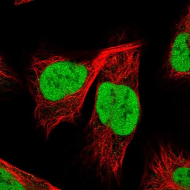 YAF2 Polyclonal Antibody, Invitrogen 100 μL; Unconjugated:Antibodies ...