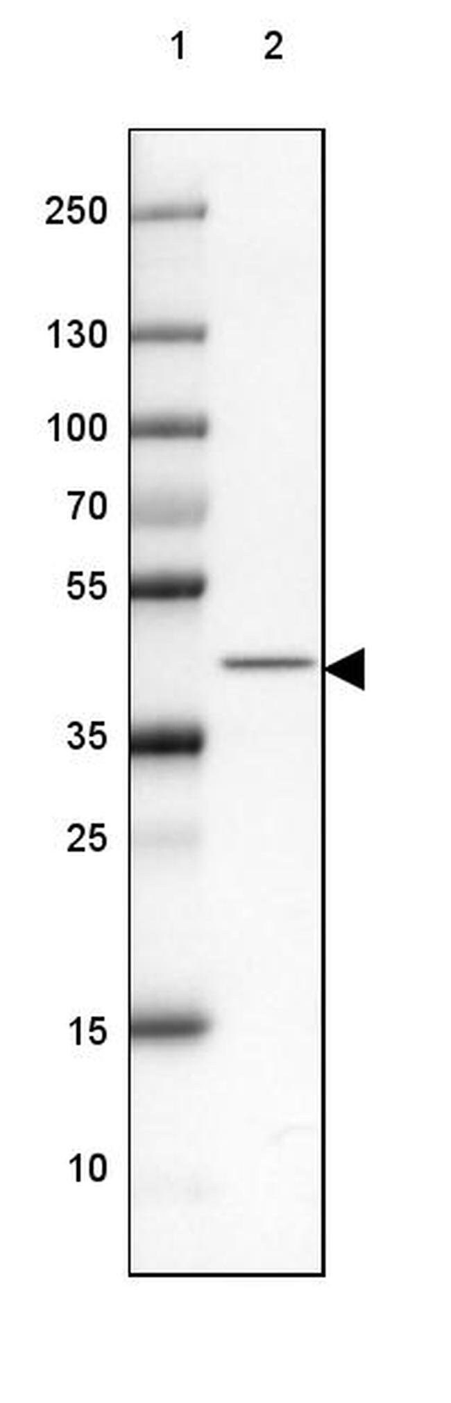 RCN2 Polyclonal Antibody, Invitrogen™ 100 μL; Unconjugated Primary ...