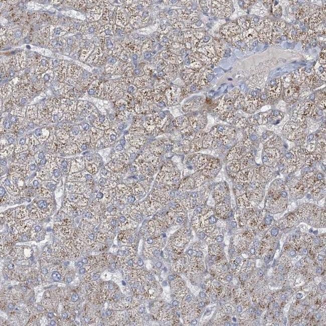 CCDC14 Polyclonal Antibody, Invitrogen™ 100 μL; Unconjugated CCDC14 ...