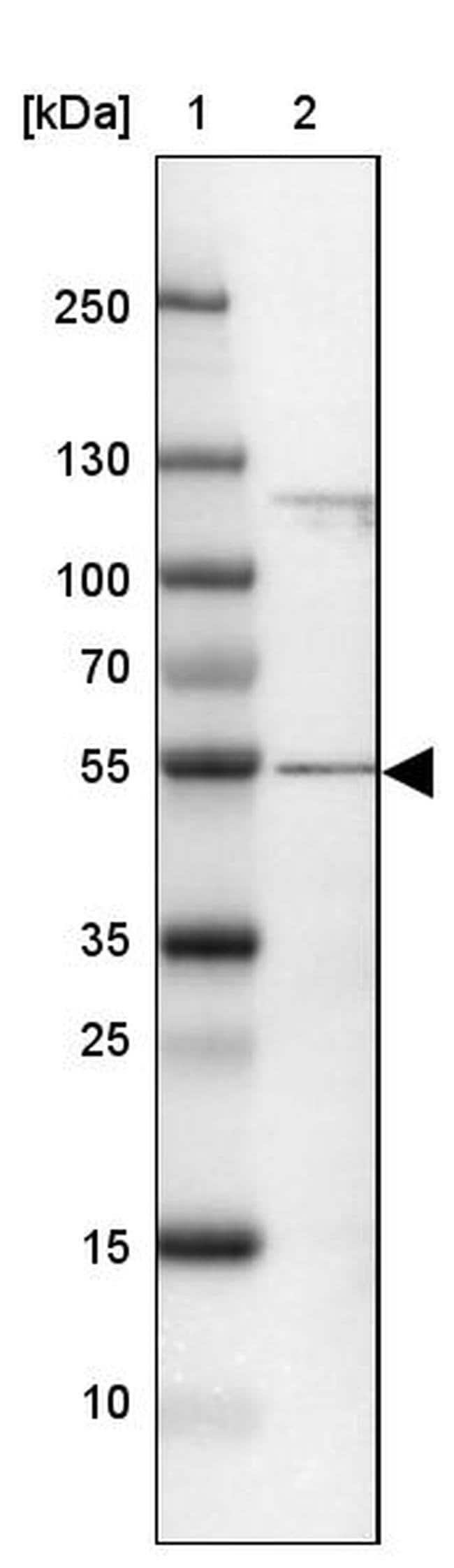 CCDC14 Polyclonal Antibody, Invitrogen™ 100 μL; Unconjugated | Fisher ...