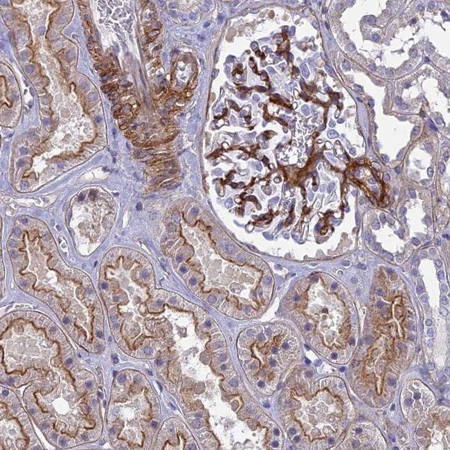 Tensin 1 Polyclonal Antibody, Invitrogen 100 μL; Unconjugated ...