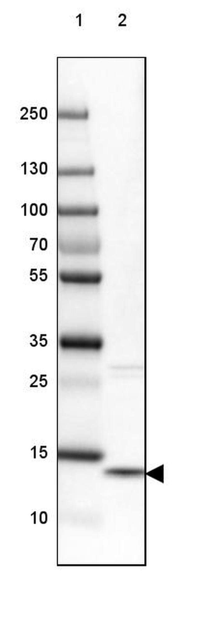 Galectin 10 Polyclonal Antibody, Invitrogen 100 μL; Unconjugated ...