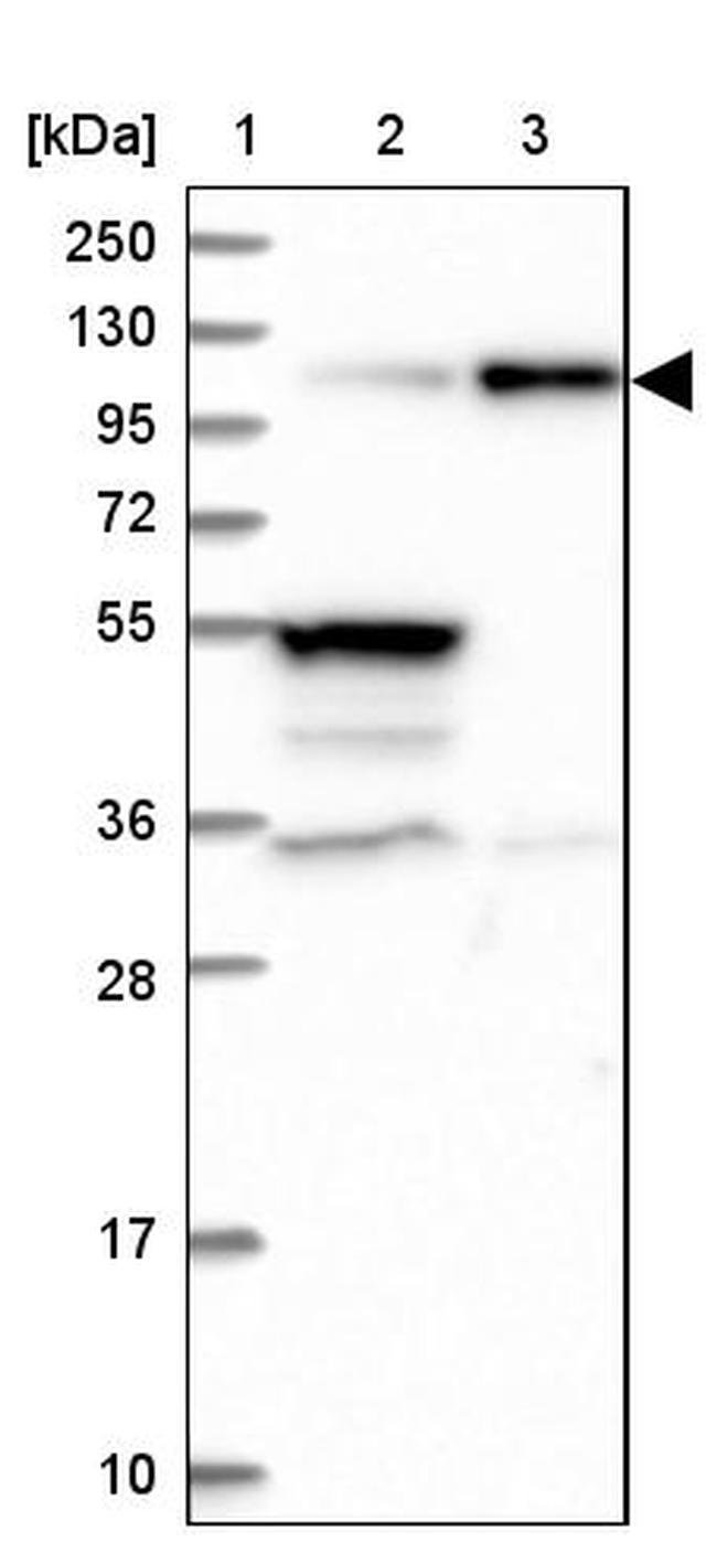 ZNF598 Polyclonal Antibody, Invitrogen 100 μL; Unconjugated:Antibodies ...