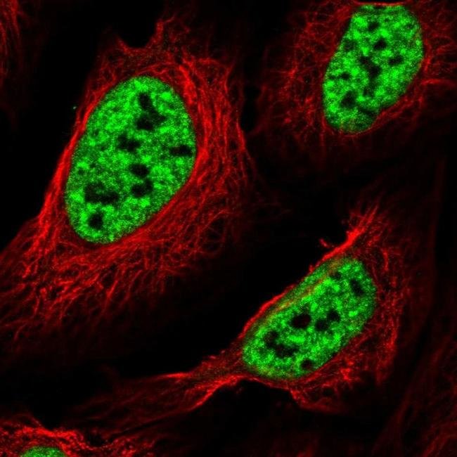 SF3B2 Polyclonal Antibody, Invitrogen 100 μL; Unconjugated:Antibodies ...