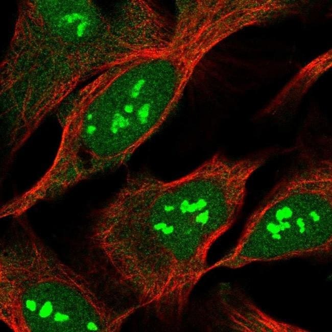 MOB2 Polyclonal Antibody, Invitrogen 100 μL; Unconjugated:Antibodies ...