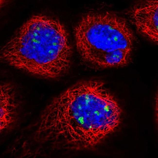 DDX27 Polyclonal Antibody, Invitrogen 100 μL; Unconjugated:Antibodies ...
