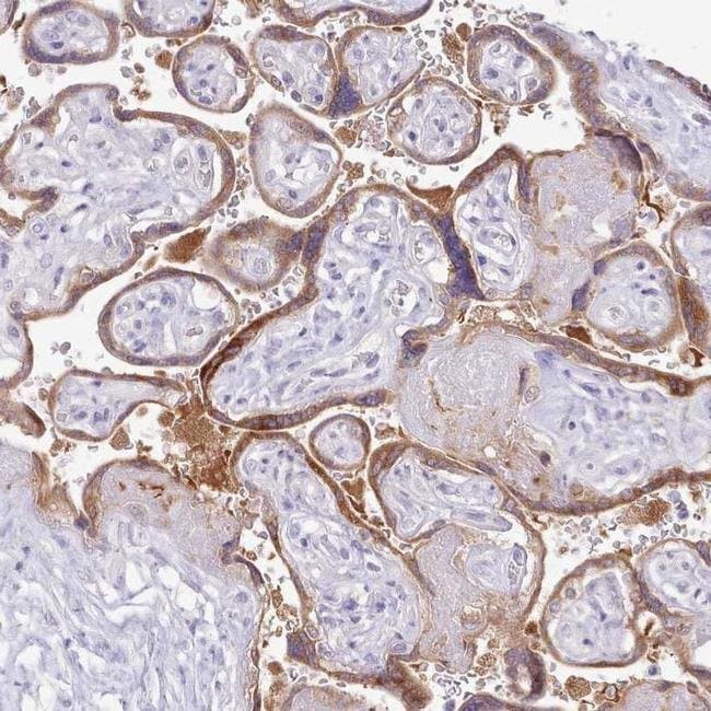 MDFI Polyclonal Antibody, Invitrogen™ 100 μL; Unconjugated Primary ...