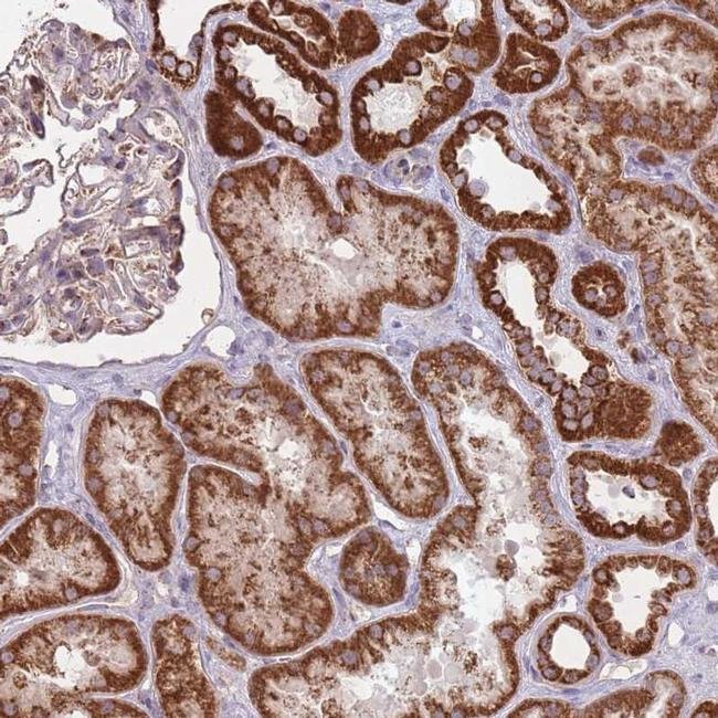 LIN7C Polyclonal Antibody, Invitrogen 100 μL; Unconjugated:Antibodies ...