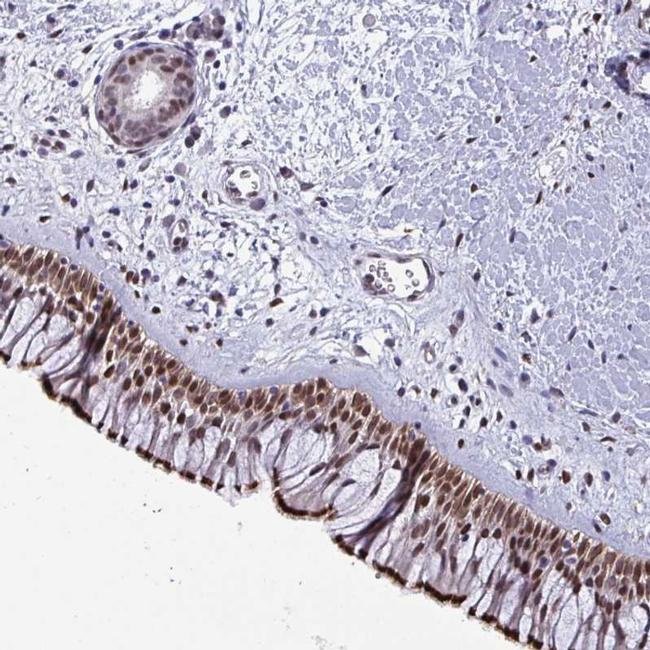 Pellino 2 Polyclonal Antibody, Invitrogen 100 μL; Unconjugated ... Pellino 2 Polyclonal Antibody, Invitrogen 100 μL; Unconjugated ...
