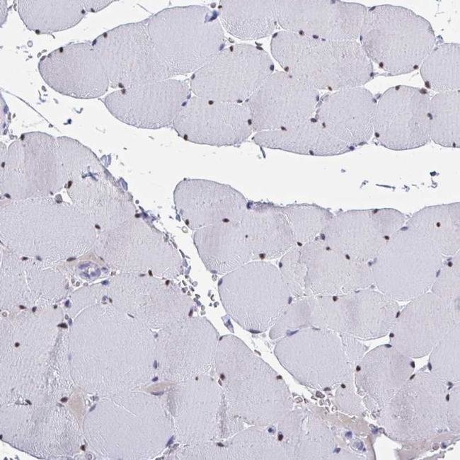 USP35 Polyclonal Antibody, Invitrogen 100 μL; Unconjugated:Antibodies ...