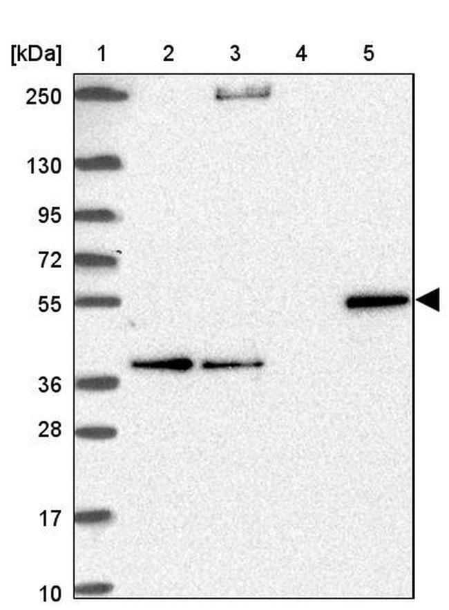 CYP27A1 Polyclonal Antibody, Invitrogen™ 100 μL; Unconjugated Primary ...
