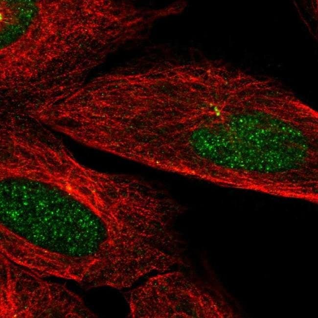 CAMK2N2 Polyclonal Antibody, Invitrogen 100 μL; Unconjugated:Antibodies ...