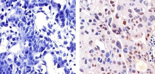 p57 Kip2 Polyclonal Antibody, Invitrogen™ 500 μL; Unconjugated | Fisher ...