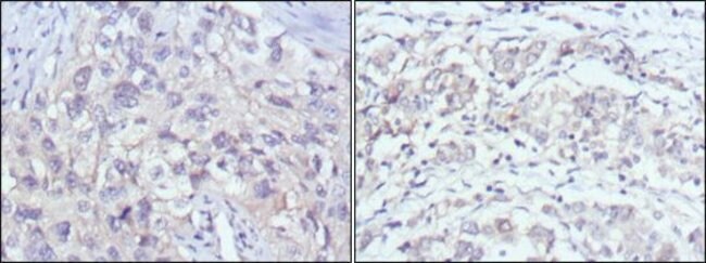 PAK2 Monoclonal Antibody (3B5), Invitrogen™ 100 μL; Unconjugated ...