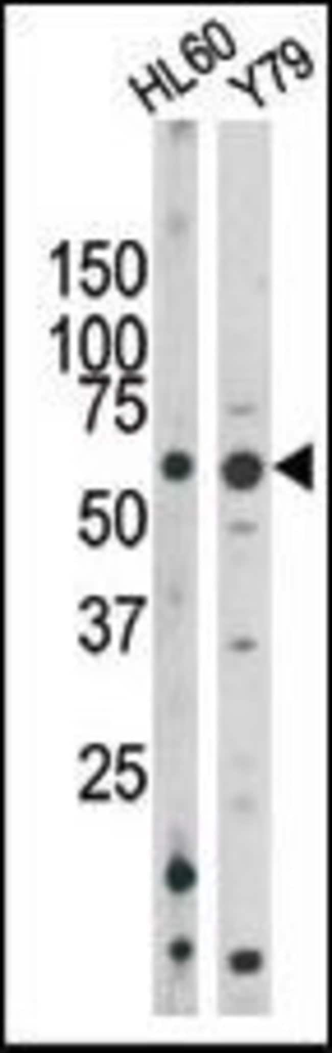 Phospho-RAD9 (Ser328) Polyclonal Antibody, Invitrogen™ 400 μL ...