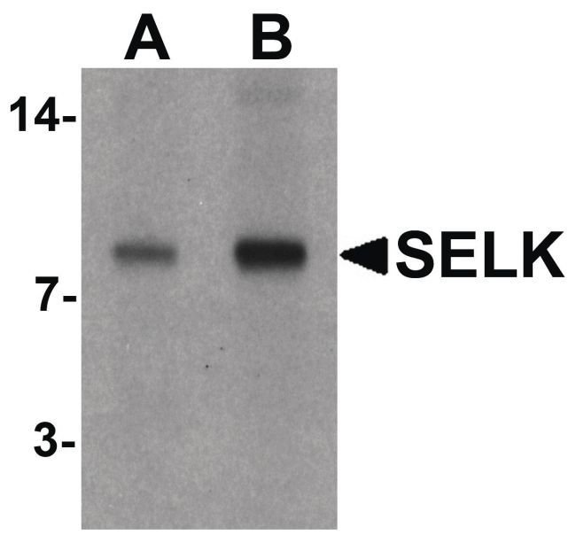 SELK Polyclonal Antibody, Invitrogen™ 100 μg; Unconjugated SELK ...