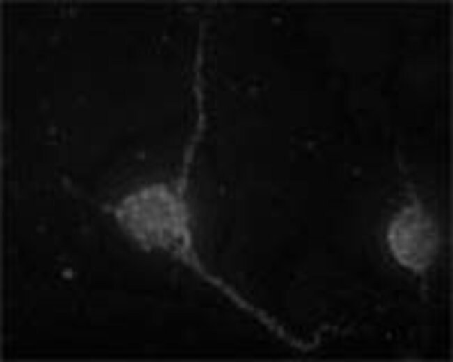 STX7 Polyclonal Antibody, Invitrogen™ 100 μL; Unconjugated Primary ...
