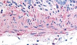 TACR2 Polyclonal Antibody, Invitrogen 50 μg; Unconjugated:Antibodies ...