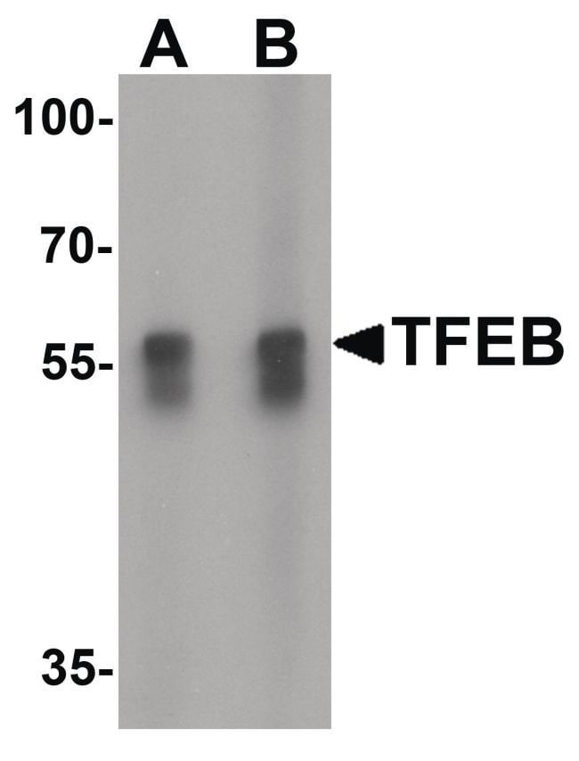 TFEB Polyclonal Antibody, Invitrogen 100 μg; Unconjugated:Antibodies ...