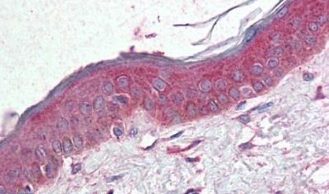 TSPAN6 Polyclonal Antibody, Invitrogen 50 μg; Unconjugated:Antibodies ...