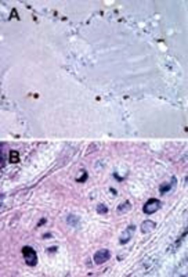 Bi-1 Monoclonal Antibody (20F430), Invitrogen™ 100 μg; Unconjugated ...