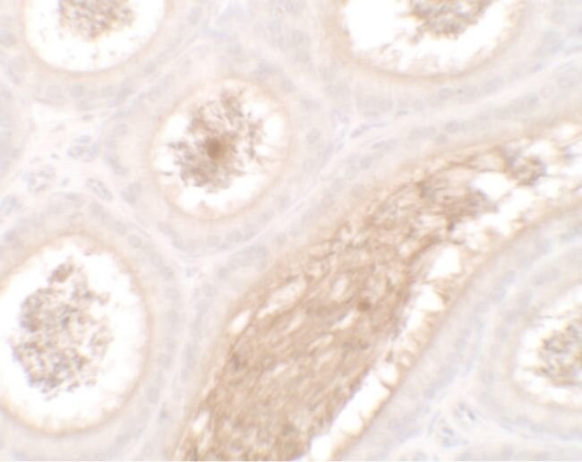 WAC Rabbit anti-Human, Mouse, Rat, Polyclonal, Invitrogen 100 μg ...