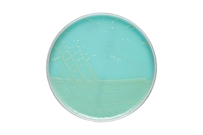 Thermo Scientific Agar Brilliance CRE Agar Brilliance CRE | Buy Online ...