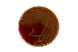 Thermo Scientific Schaedler Anaerobe Agar with Sheep Blood, Haemin ...