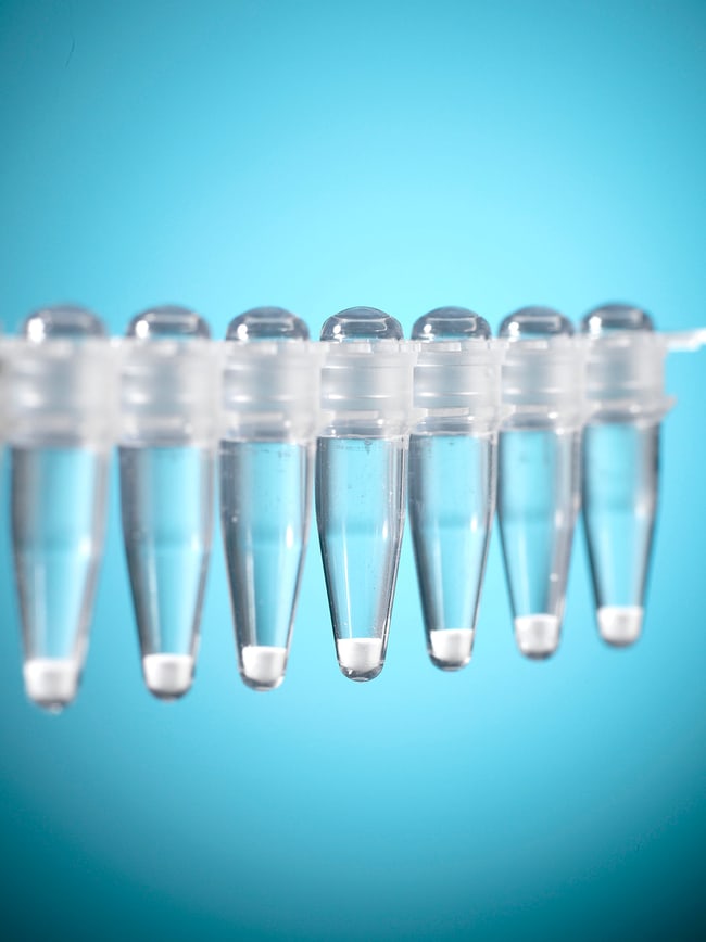 Thermo Scientific qualyfast Legionella PCR and DNA Extraction Kits ...